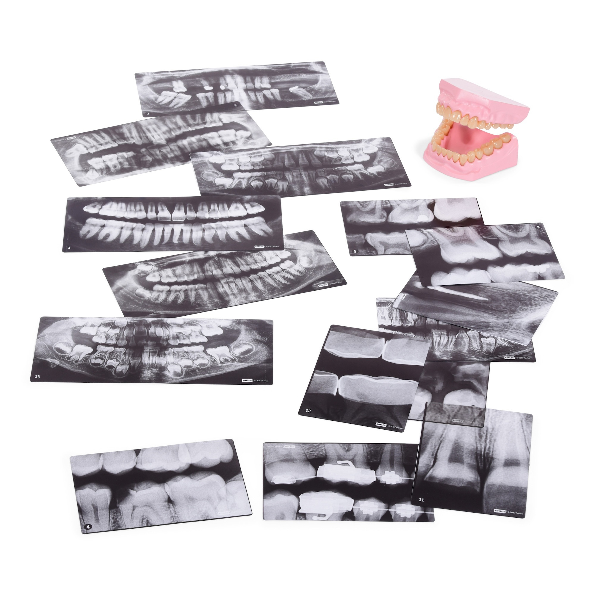 Human Teeth & X-rays Collection