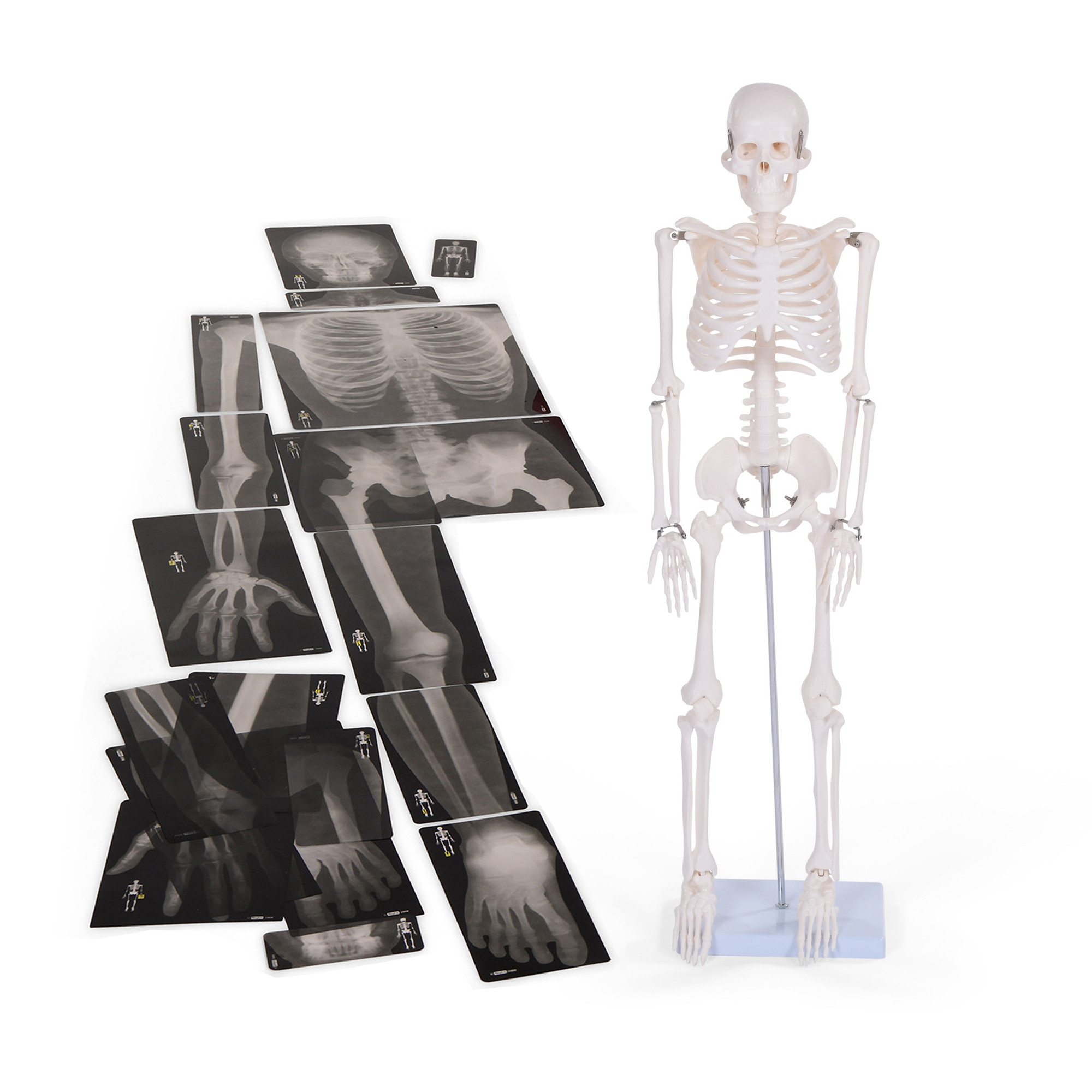 Human Skeleton & X-rays Collection